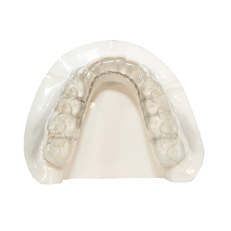 Elite Dental Laboratory Bite Splints
