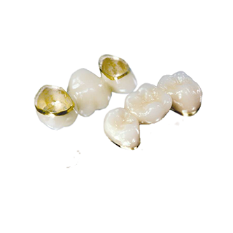 Elite Dental Laboratory Captek