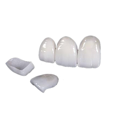 Elite Dental Laboratory Veneers
